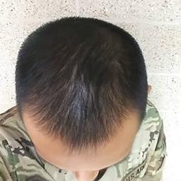 Keeps | Hair Loss Treatment for Men